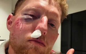 Ben Stokes Undergoes Successful Eye Surgery After Freak Net Session Injury